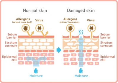 normal-skin-damage-skin – Positive Parenting